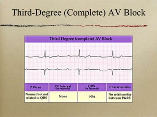 10-AV-blocks.ppt | Heart and Cardiovascular Diseases | Diseases and ...