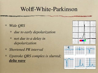 10-AV-blocks.ppt wolff oarkinson white disease | PPT
