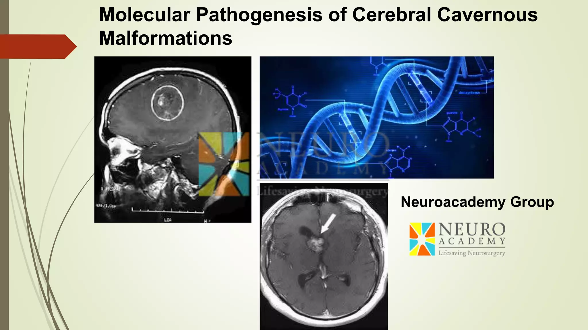 Molecular Pathogenesis of Cerebral Cavernous Malformations | PPTX