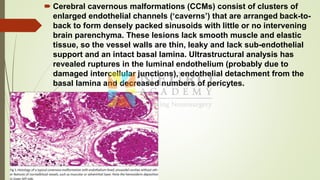 Molecular Pathogenesis of Cerebral Cavernous Malformations | PPTX