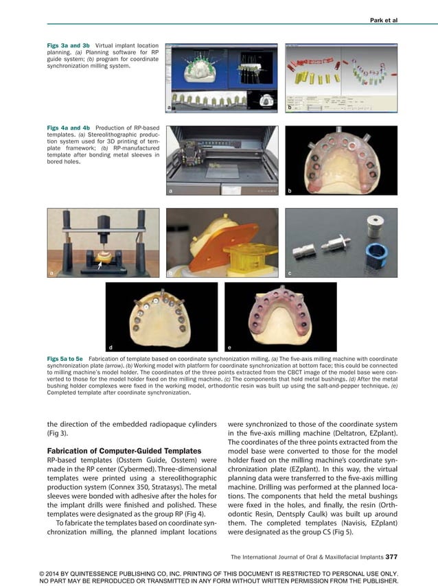 10 - Comparison of five-axis milling and rapid prototyping for implant ...