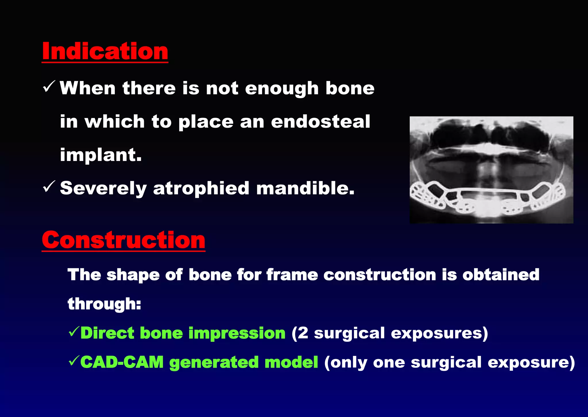 10- Dental Implants.ppt