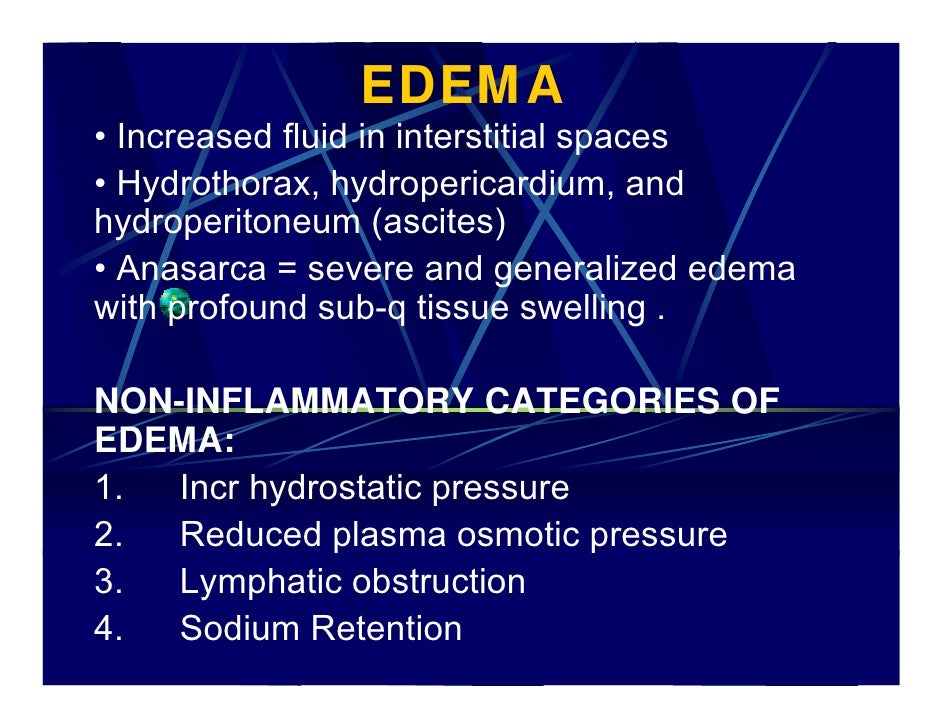 Edema