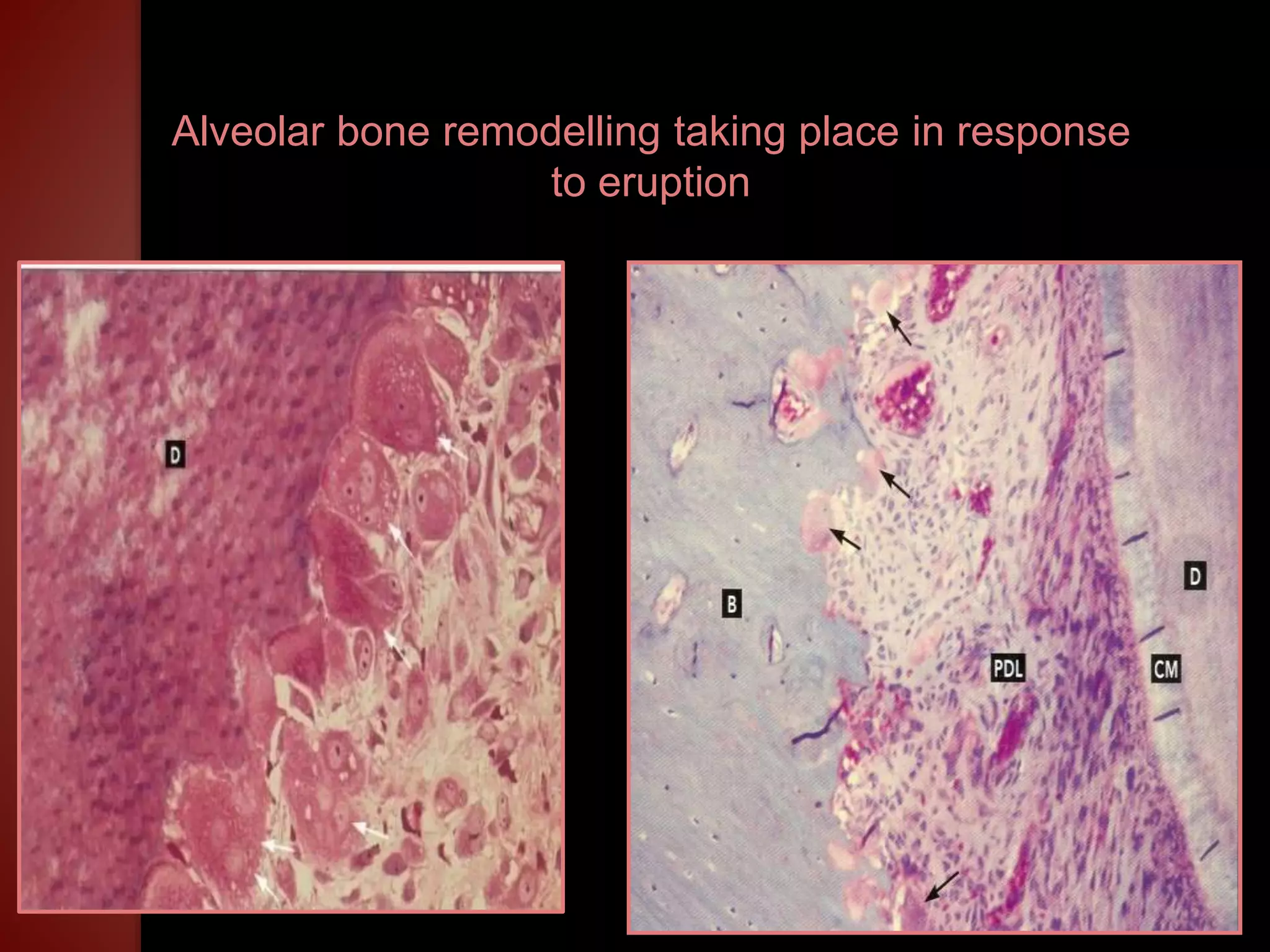 Eruption, shedding & teething problems | PPT