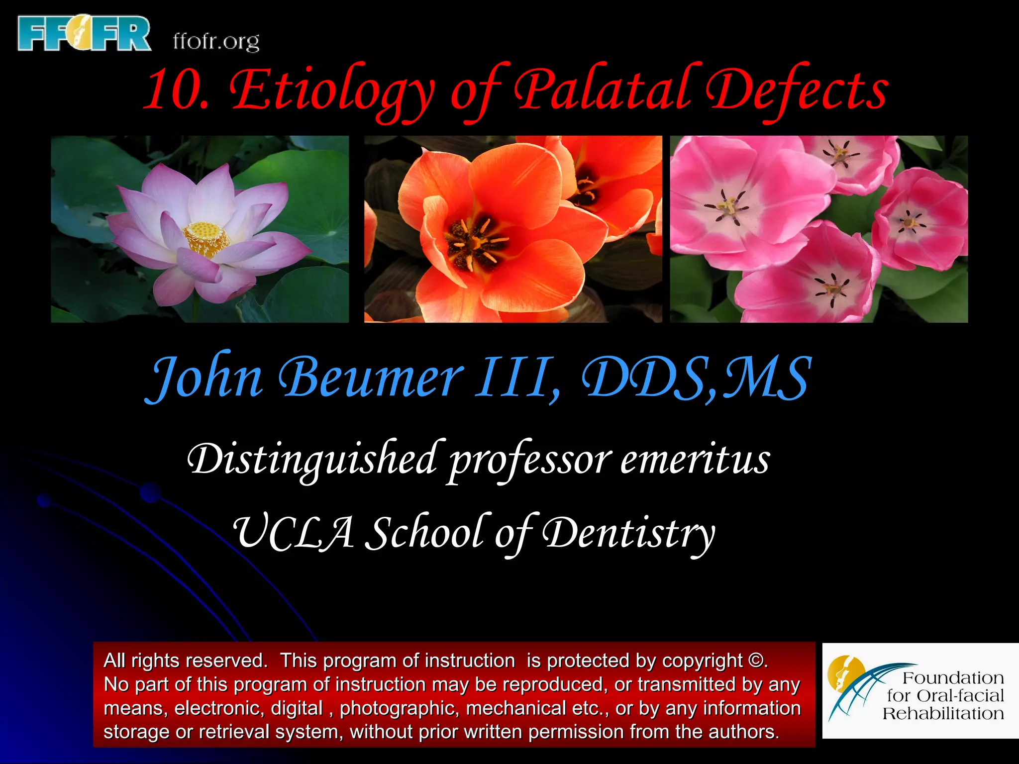 10. etiology of palatal and paranasal sinus defects | PPT | Ear, Nose ...