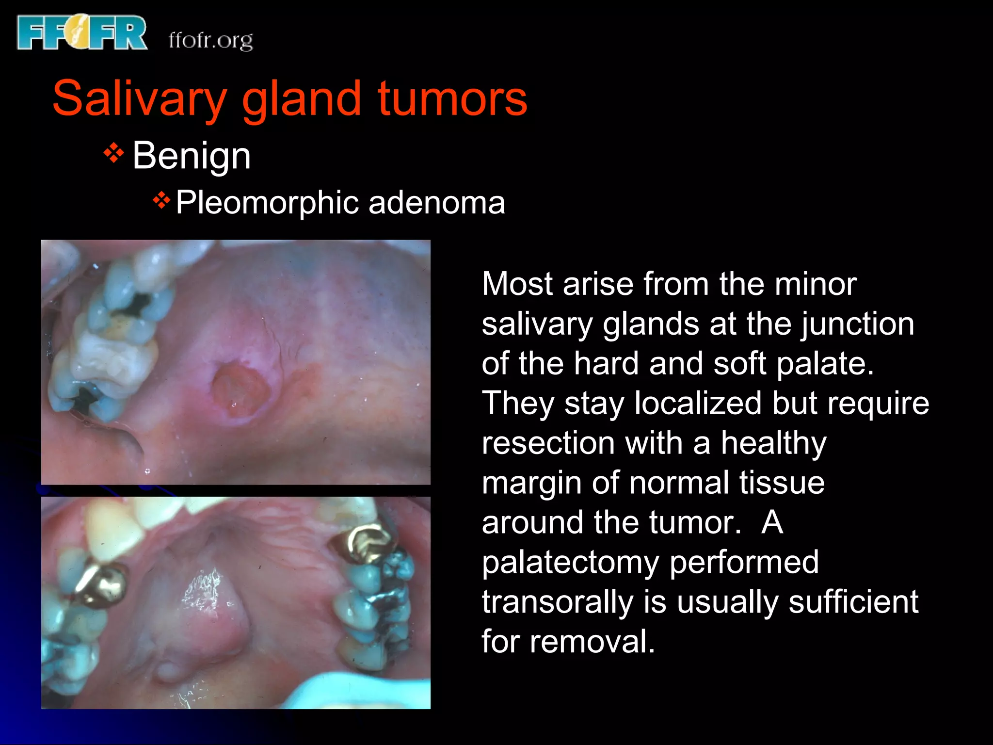 10. etiology of palatal and paranasal sinus defects | PPT | Ear, Nose ...