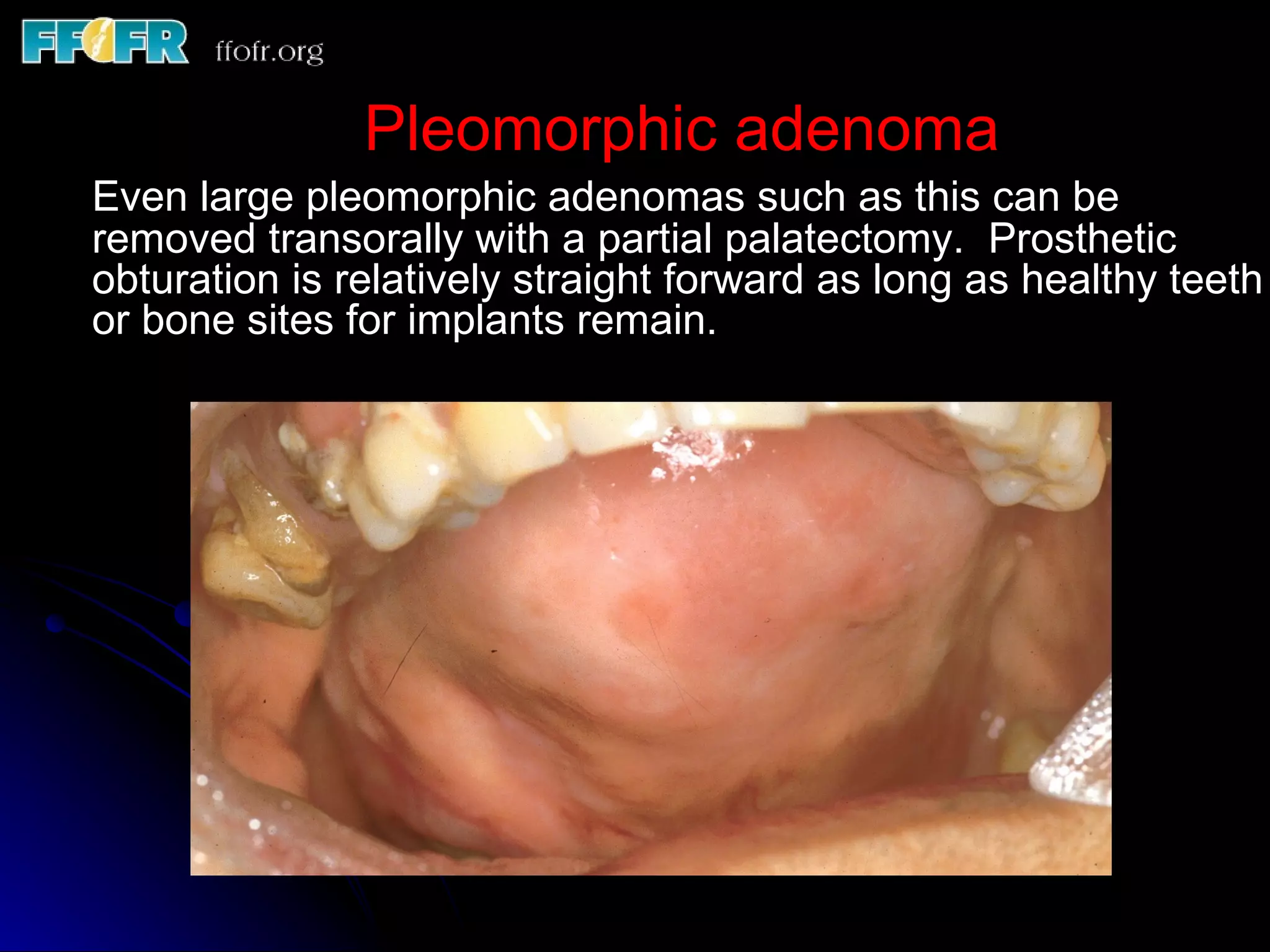 10. etiology of palatal and paranasal sinus defects | PPT | Ear, Nose ...