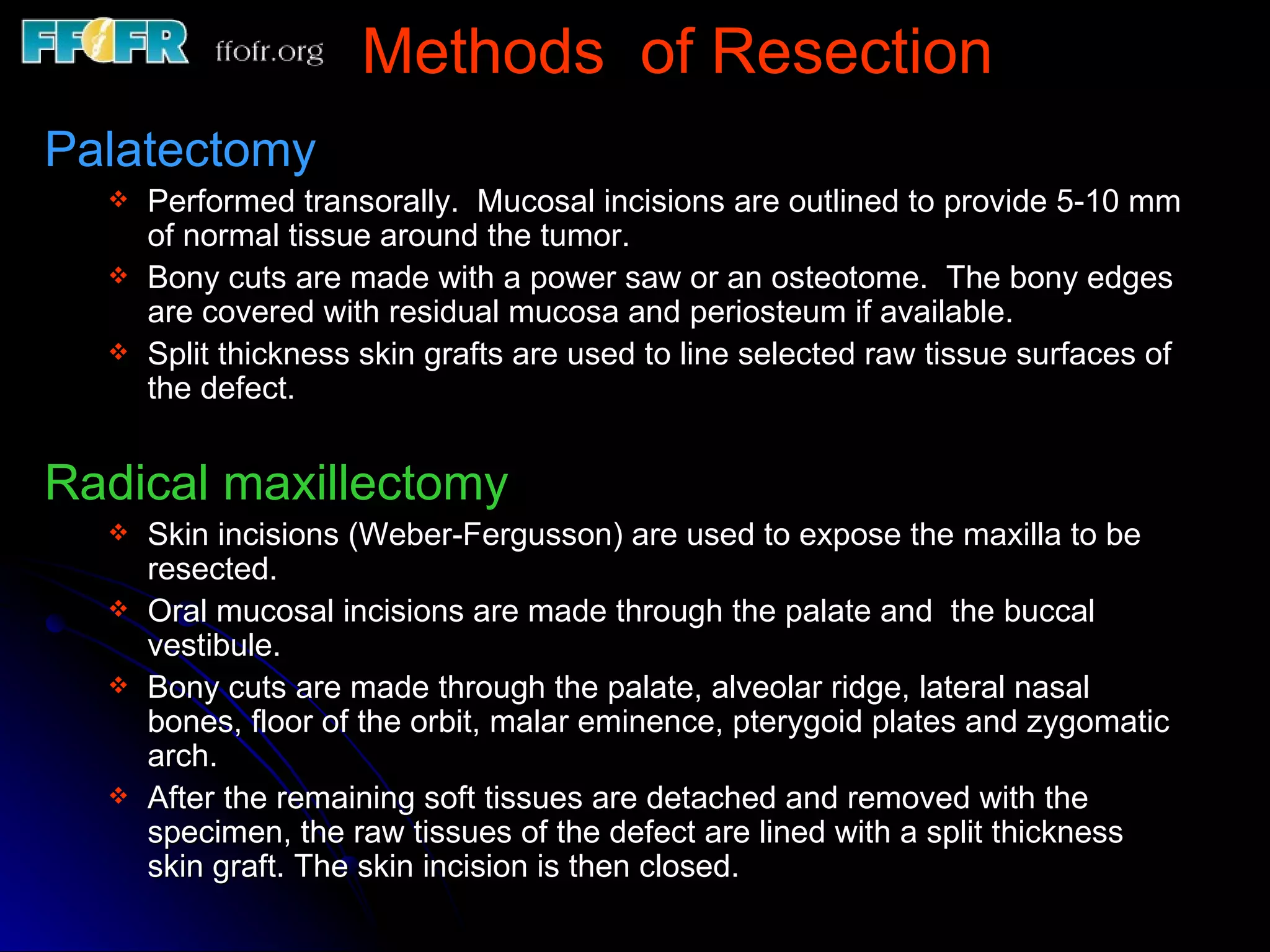 10. etiology of palatal and paranasal sinus defects | PPT | Ear, Nose ...