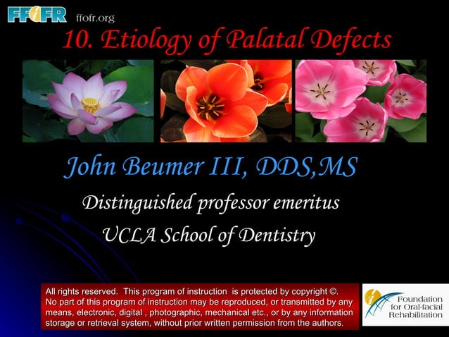 10. etiology of palatal and paranasal sinus defects | PPT | Ear, Nose ...