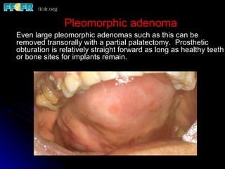 10. etiology of palatal and paranasal sinus defects | PPT