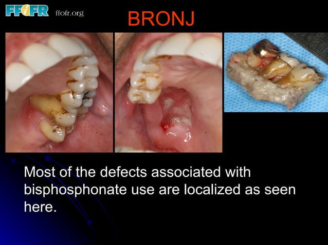 10. etiology of palatal and paranasal sinus defects | PPT | Ear, Nose ...