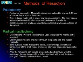10. etiology of palatal and paranasal sinus defects | PPT
