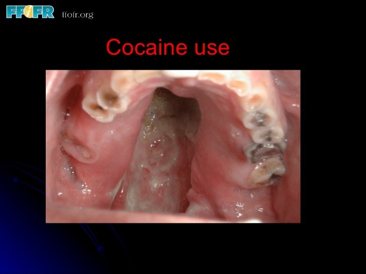 10. etiology of palatal and paranasal sinus defects