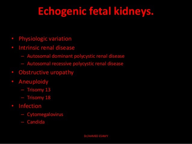 10 Fetal Urinary Tract Dr Ahmed Esawy
