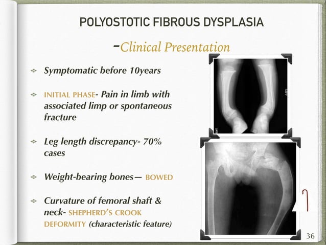 Fibro-osseous Lesions | PDF | Bone and Joint Conditions | Diseases and ...