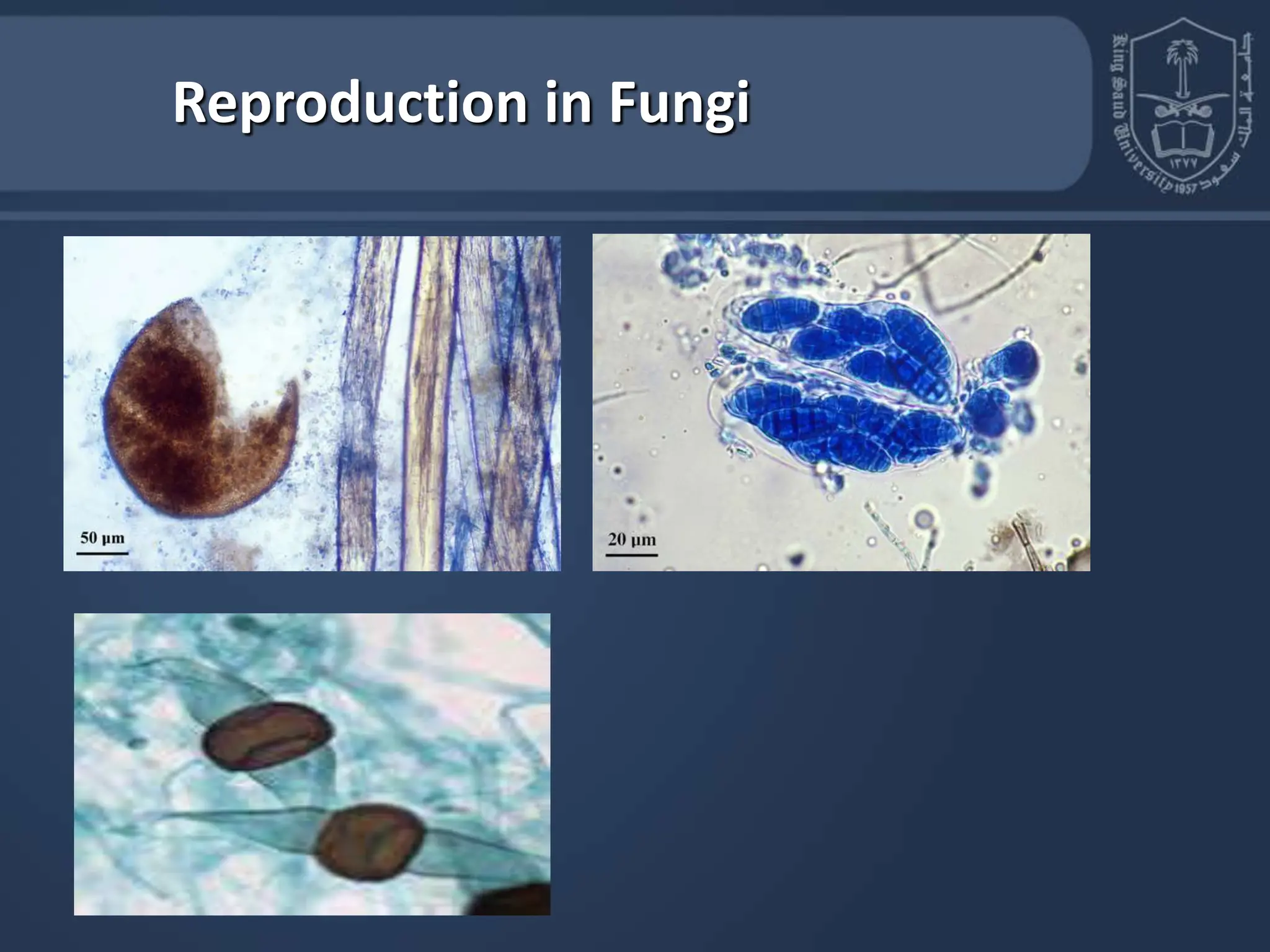 10- Fungi and Their Pathogenesis. ppt | PPT