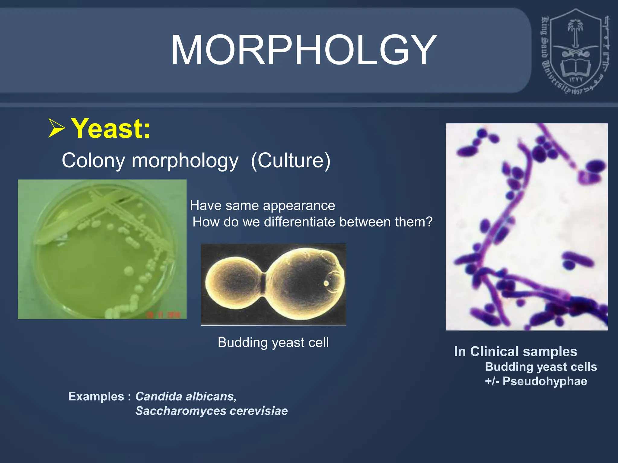 10- Fungi and Their Pathogenesis. ppt | PPT