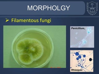 10- Fungi and Their Pathogenesis. ppt | PPT