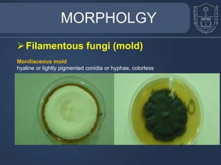 10- Fungi and Their Pathogenesis. ppt | PPT