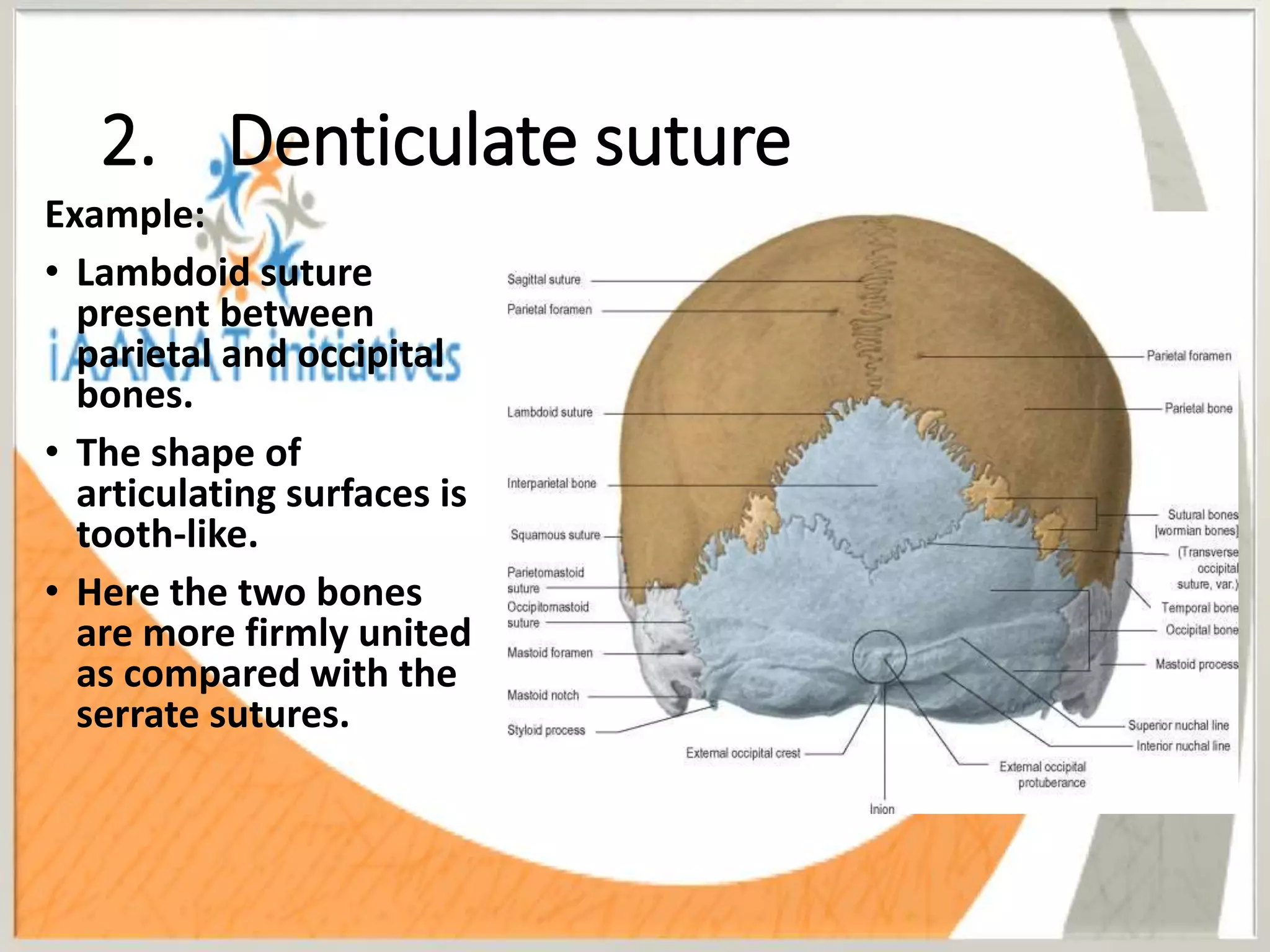 classification of joints and characteristics of each type joint | PPTX