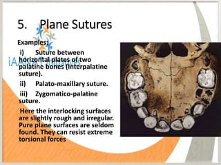 Plane Suture