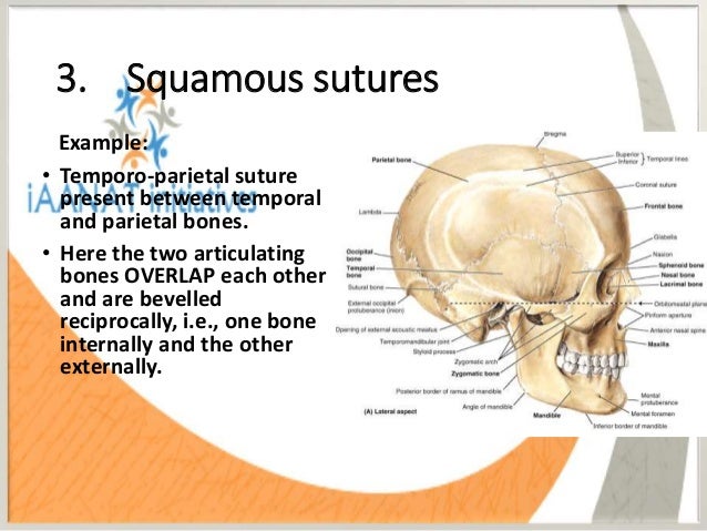 classification of joints and characteristics of each type joint