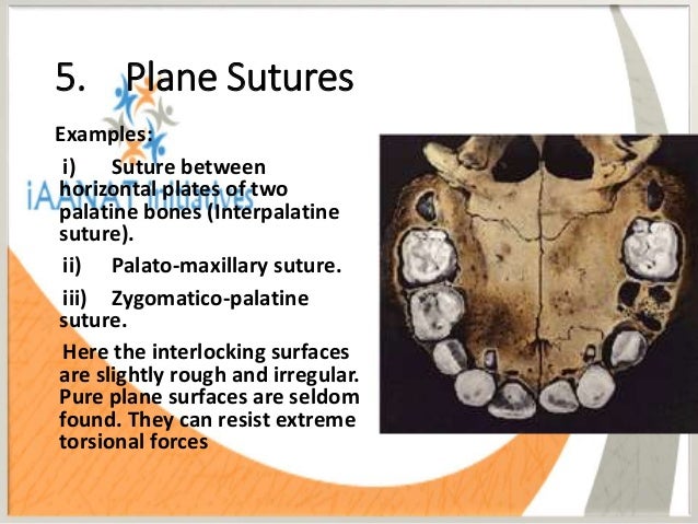 classification of joints and characteristics of each type joint