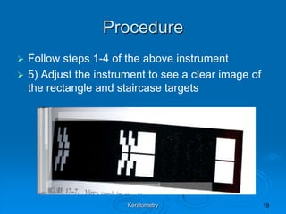 keratometry | PPT