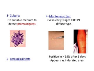 A lecture Leish & trypanosoma Parasites.pdf