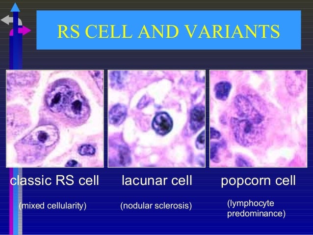 10..lymphoma final year