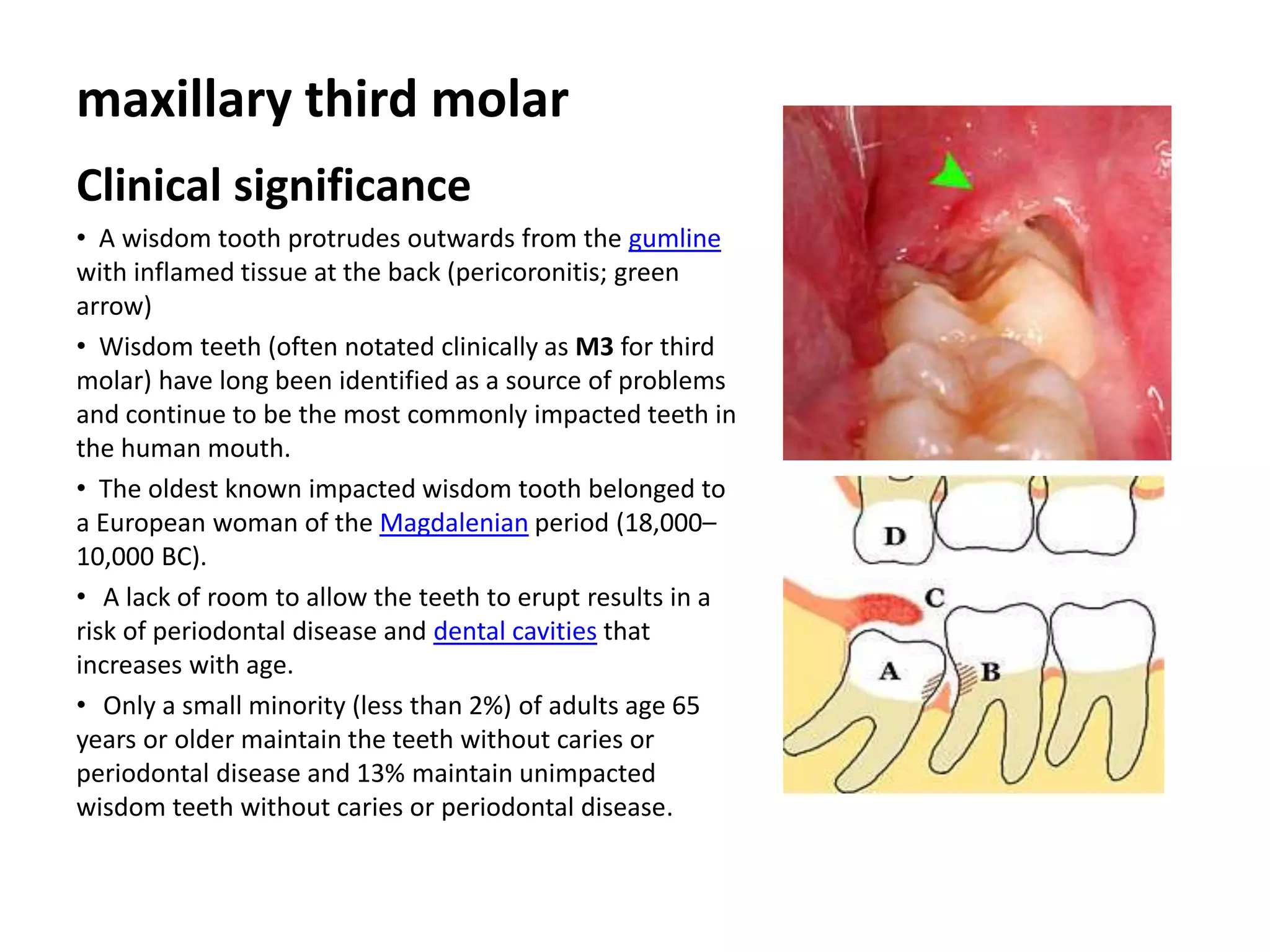 10 maxillary ( first , second , third ) molars . | PPTX