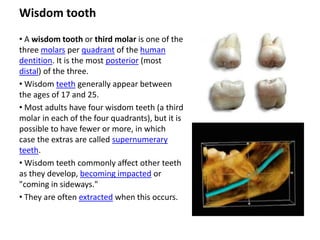 10 maxillary ( first , second , third ) molars . | PPT