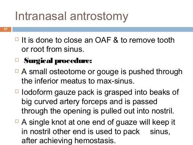 10 maxillary sinus