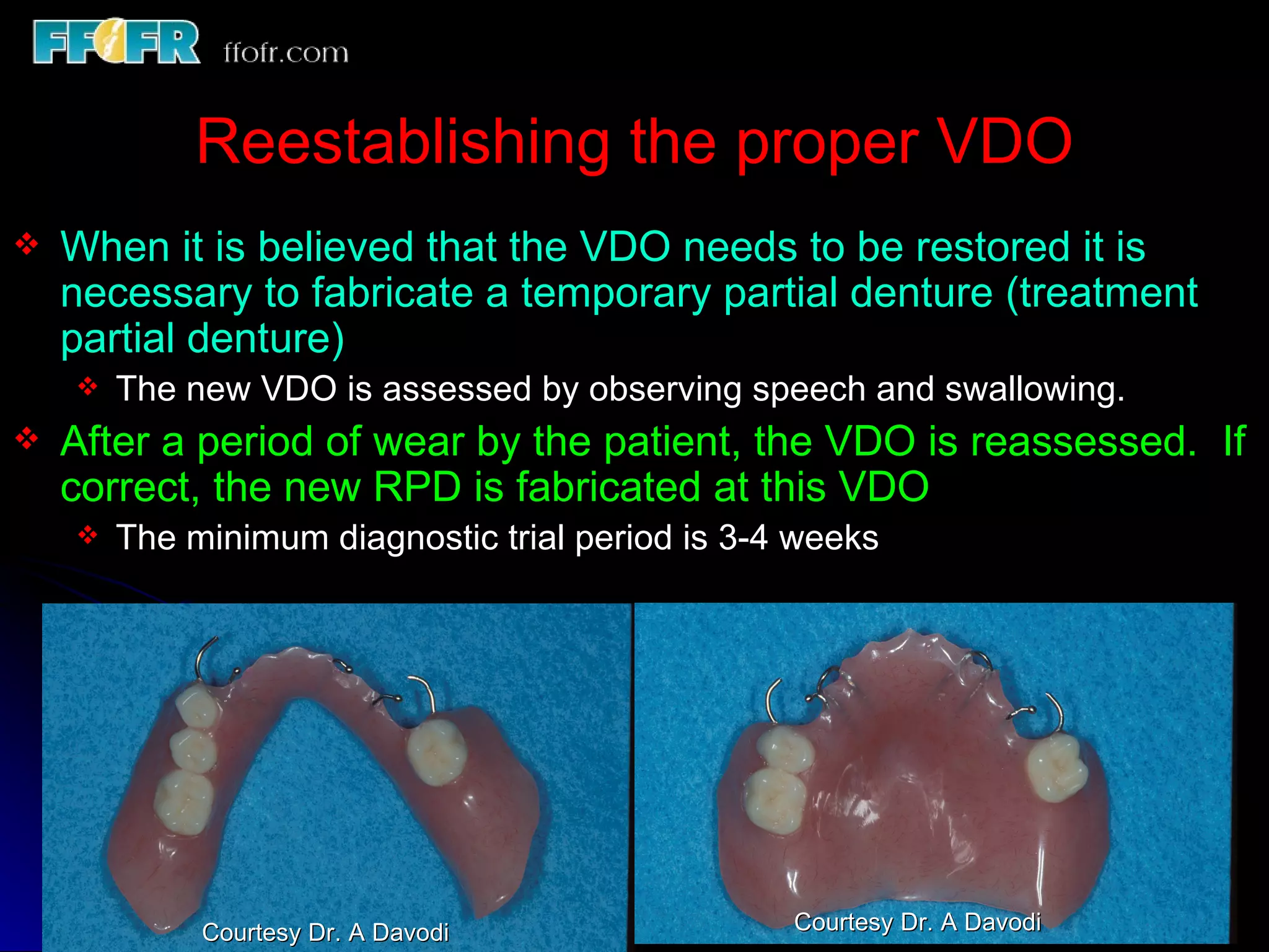 10.maxillo mandibular records | PPT