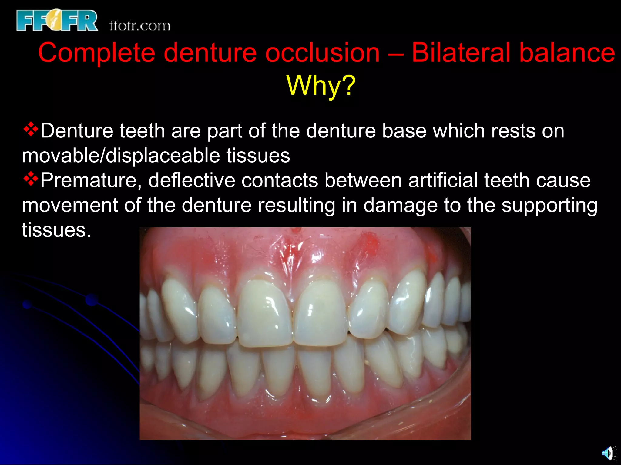 10.maxillo mandibular records | PPT