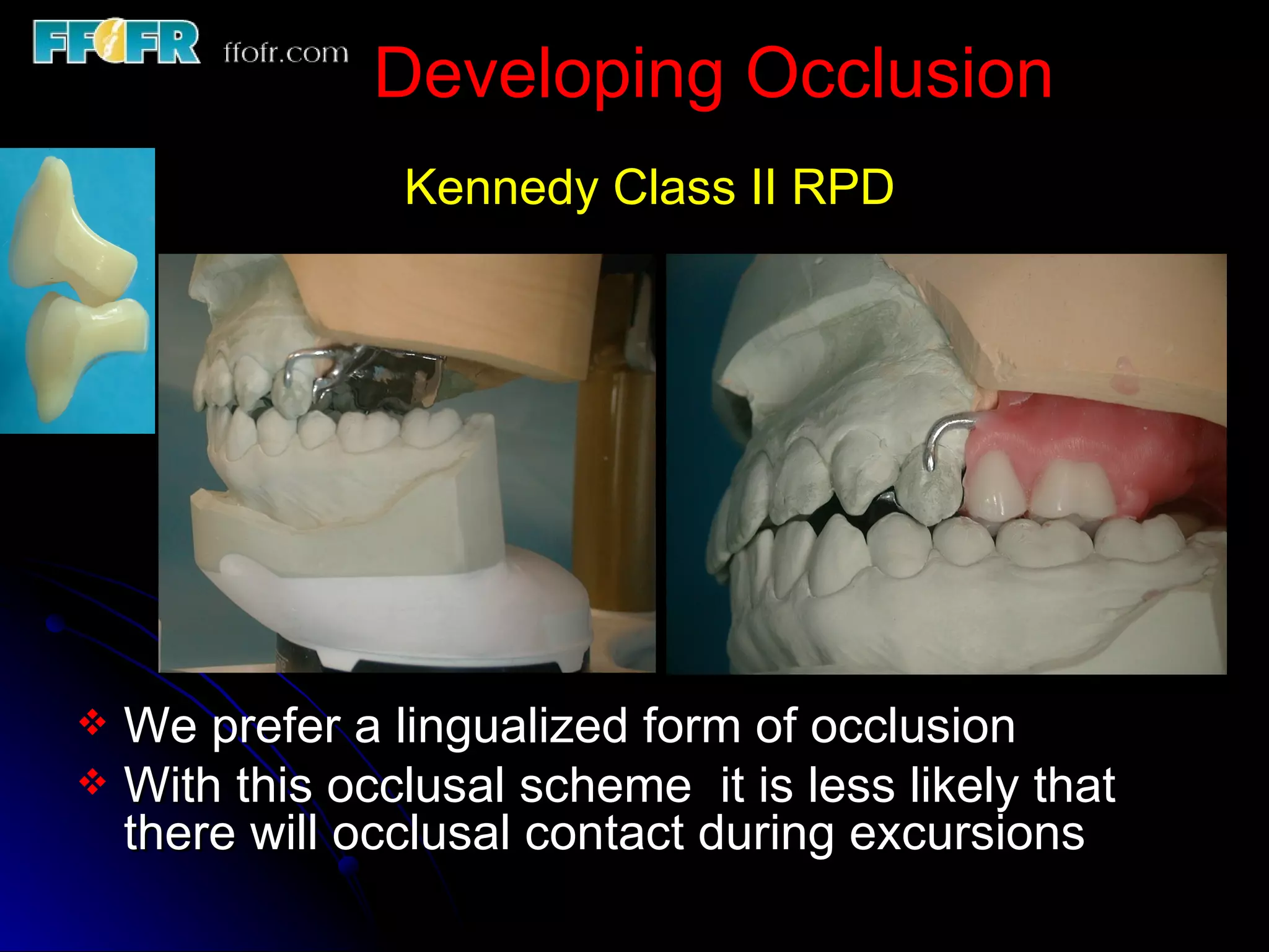 10.maxillo mandibular records | PPT
