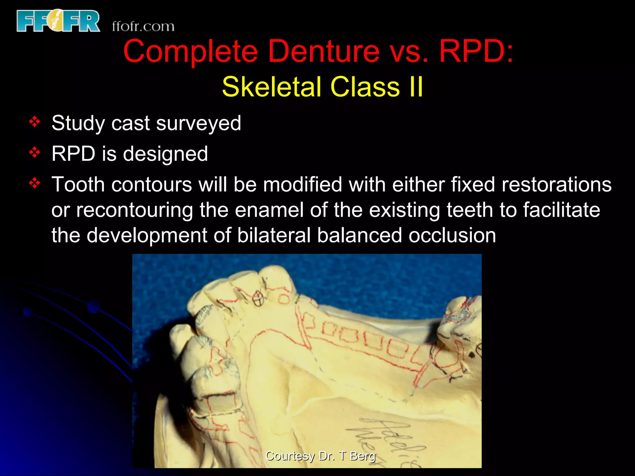10.maxillo mandibular records | PPT