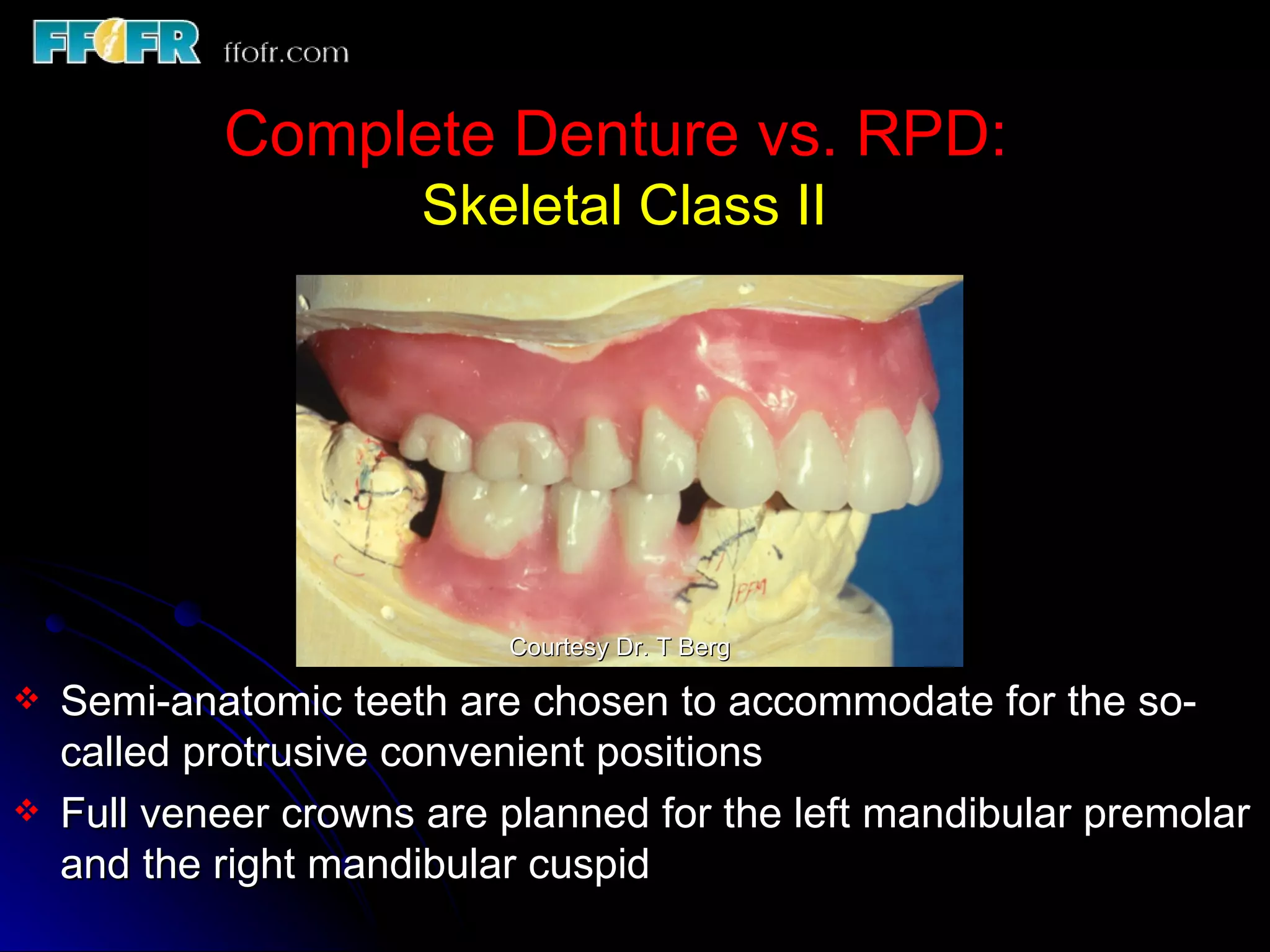 10.maxillo mandibular records | PPT