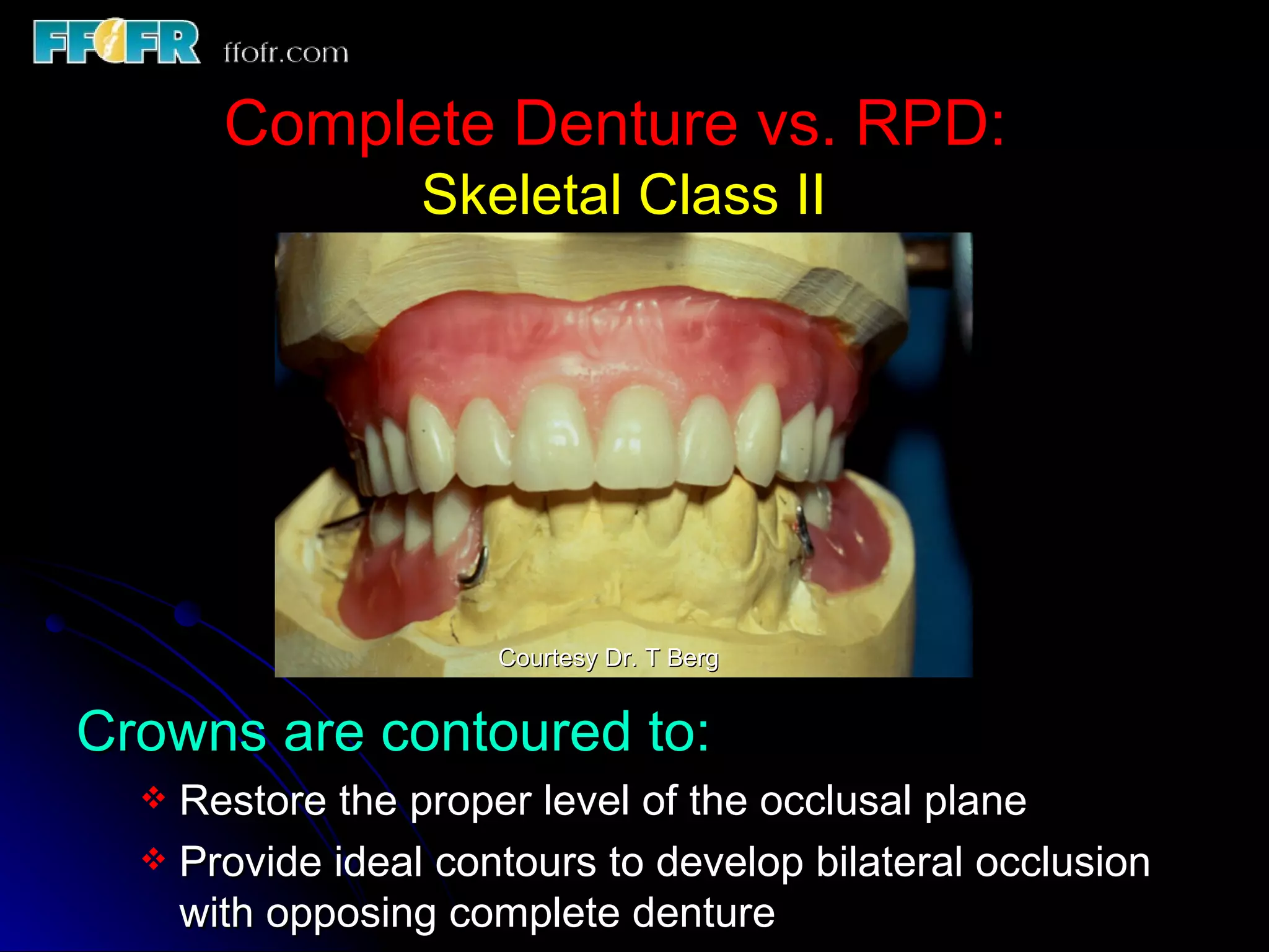 10.maxillo mandibular records | PPT