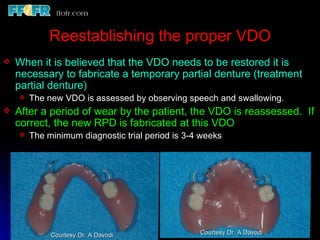 10.maxillo mandibular records | PPT