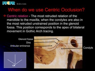 10.maxillo mandibular records | PPT