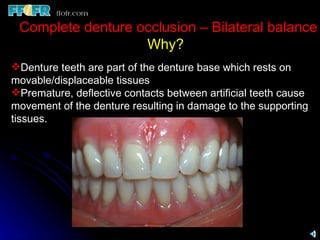 10.maxillo mandibular records | PPT