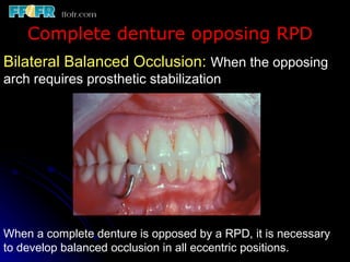 10.maxillo mandibular records | PPT
