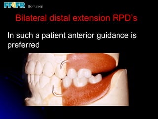 10.maxillo mandibular records | PPT