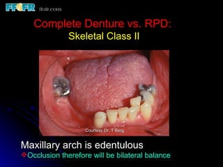 10.maxillo mandibular records | PPT