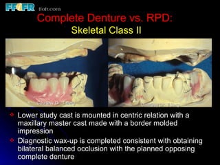 10.maxillo mandibular records | PPT