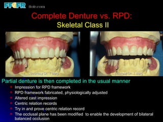 10.maxillo mandibular records | PPT