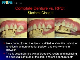 10.maxillo mandibular records | PPT