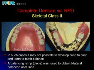 10.maxillo mandibular records | PPT