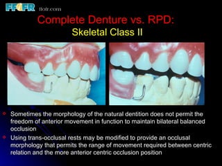 10.maxillo mandibular records | PPT